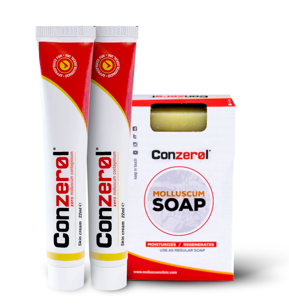 Buy now molluscum treatment - Conzerol